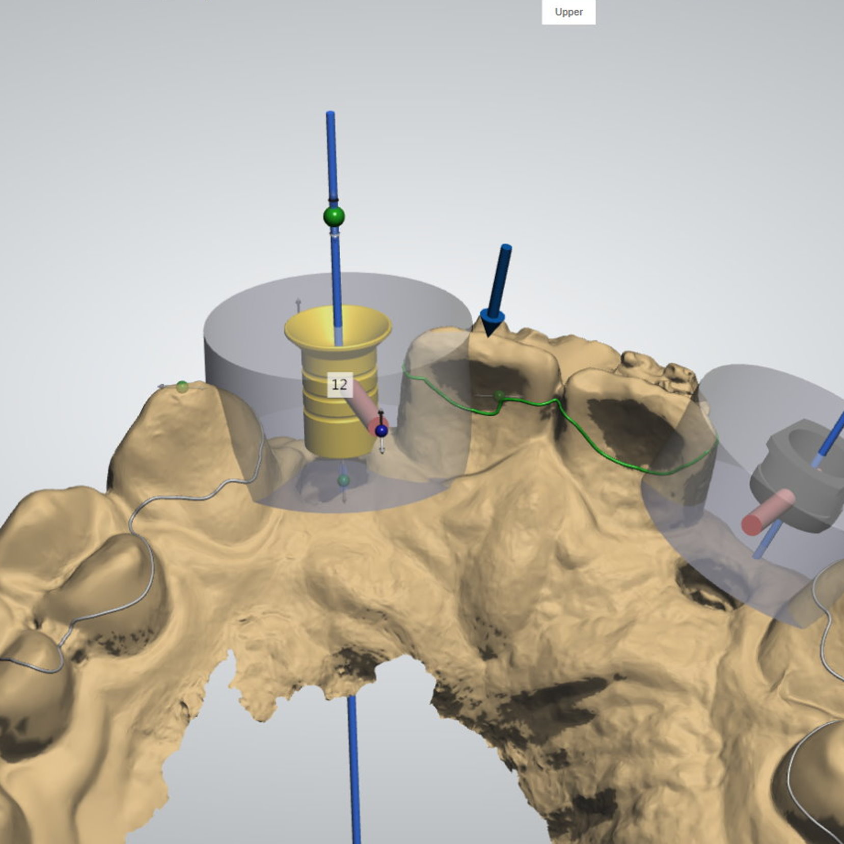 sleeves for guided surgery – Steco