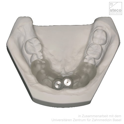 Guided Endo – Steco
